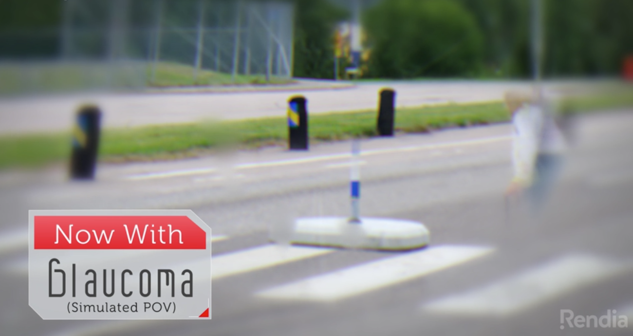 How Glaucoma Affects Vision